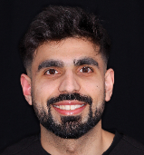 Dr. Aadil Malik | Invisalign