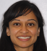 Dr. Divya Datta DENTAL BEAUTY | Invisalign