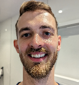 Dr. Harry Marshall PORTMAN | Invisalign
