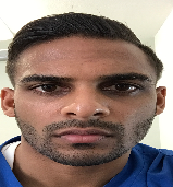 Dr. Keval Amin | Invisalign