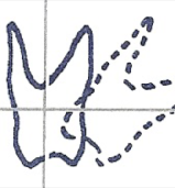 Dr. MARIA JOSE RODRIGO COBOS | Invisalign