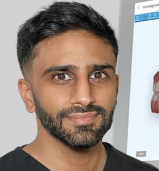 Shaimil Patel PERFECT SMILE | Invisalign